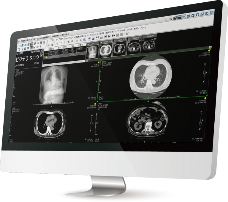 SoliPACS for PIXTERA 病院向けPACS | 株式会社ピクテラ